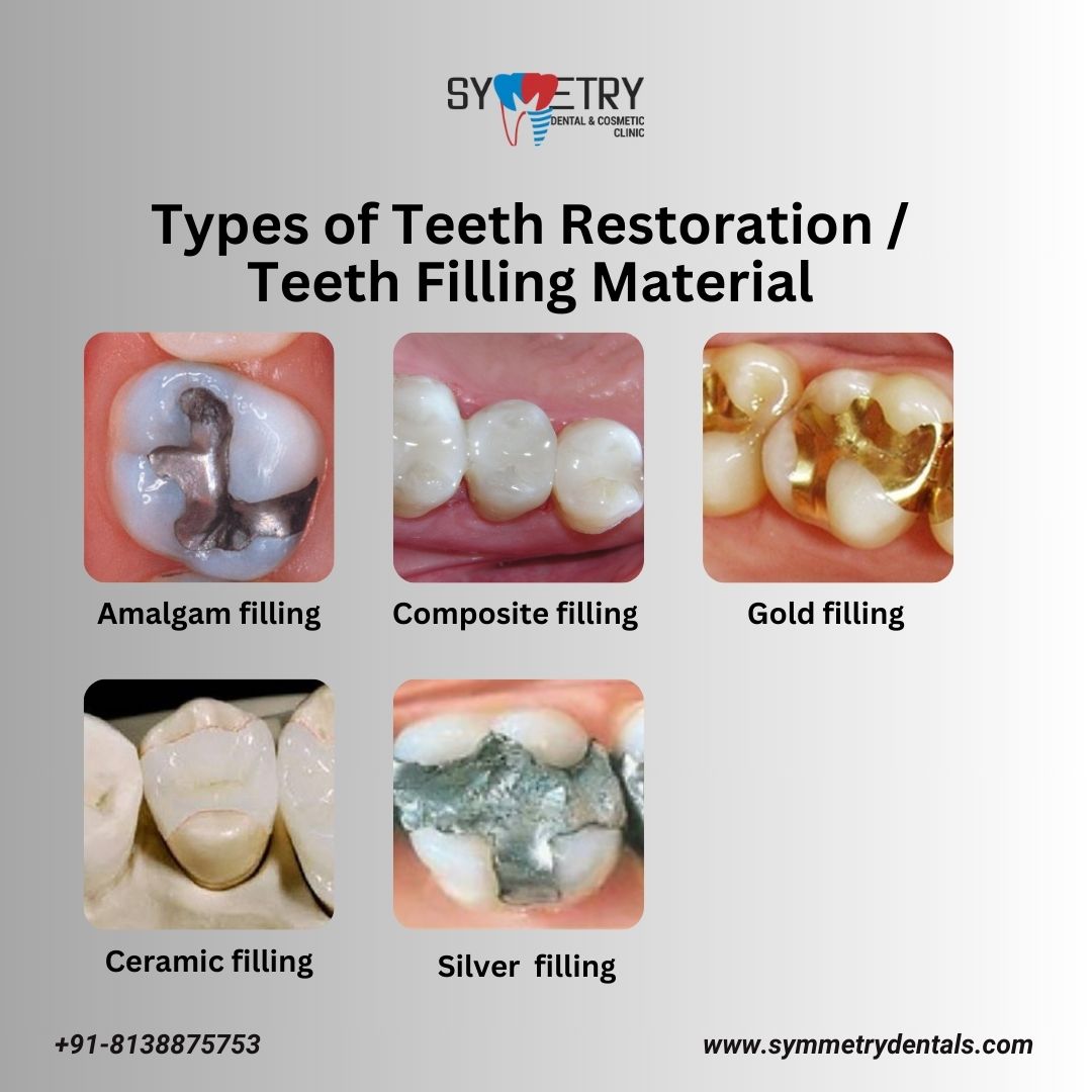 Everything About Dental Fillings: Types, Costs & Painless Procedures